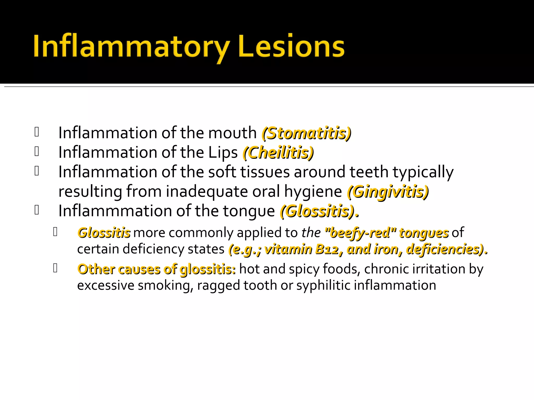 Diseases of oral cavity and ludwig’s angina ug,18.07.16 dr.davis thomas ...