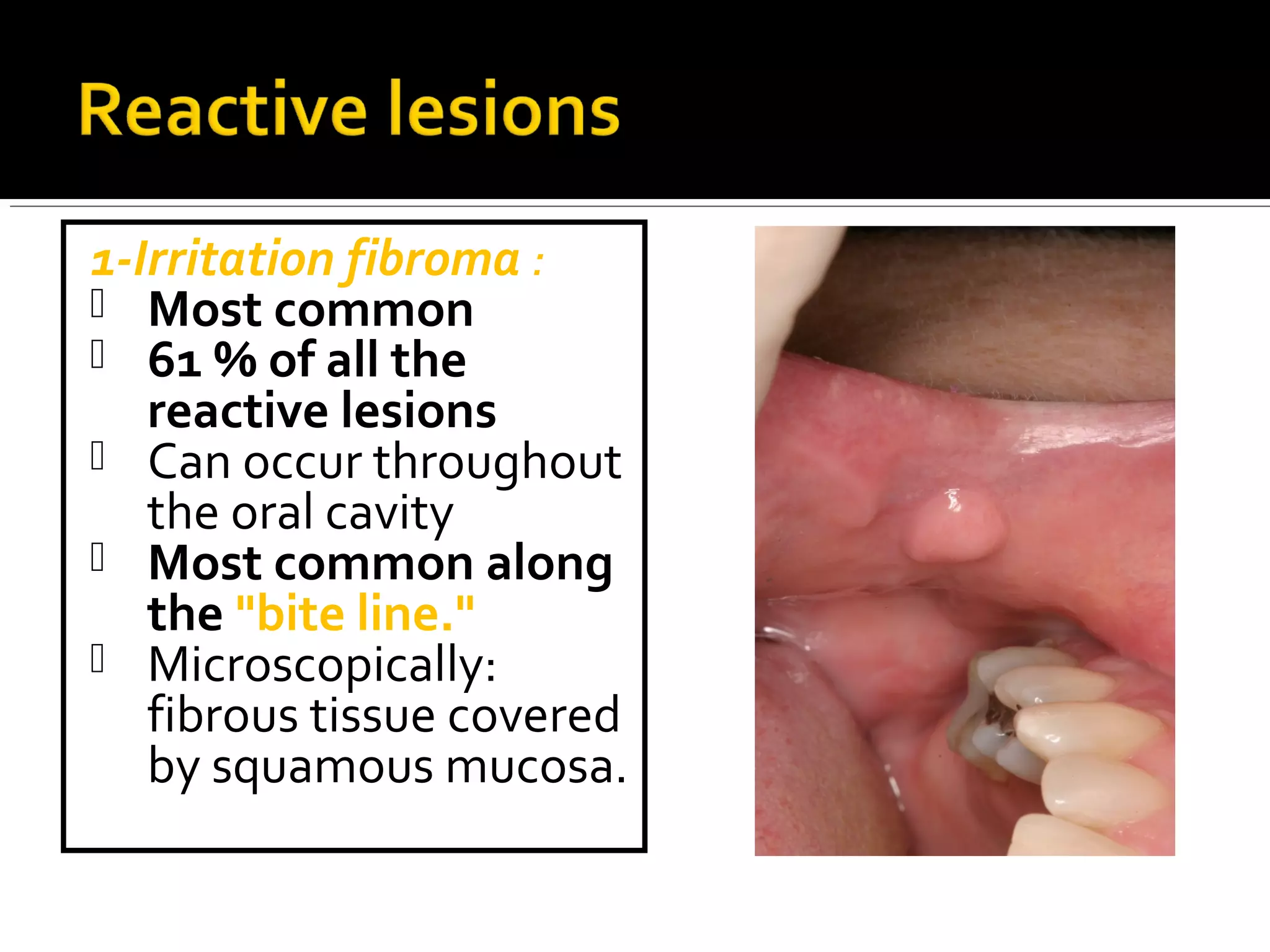 Diseases of oral cavity and ludwig’s angina ug,18.07.16 dr.davis thomas ...