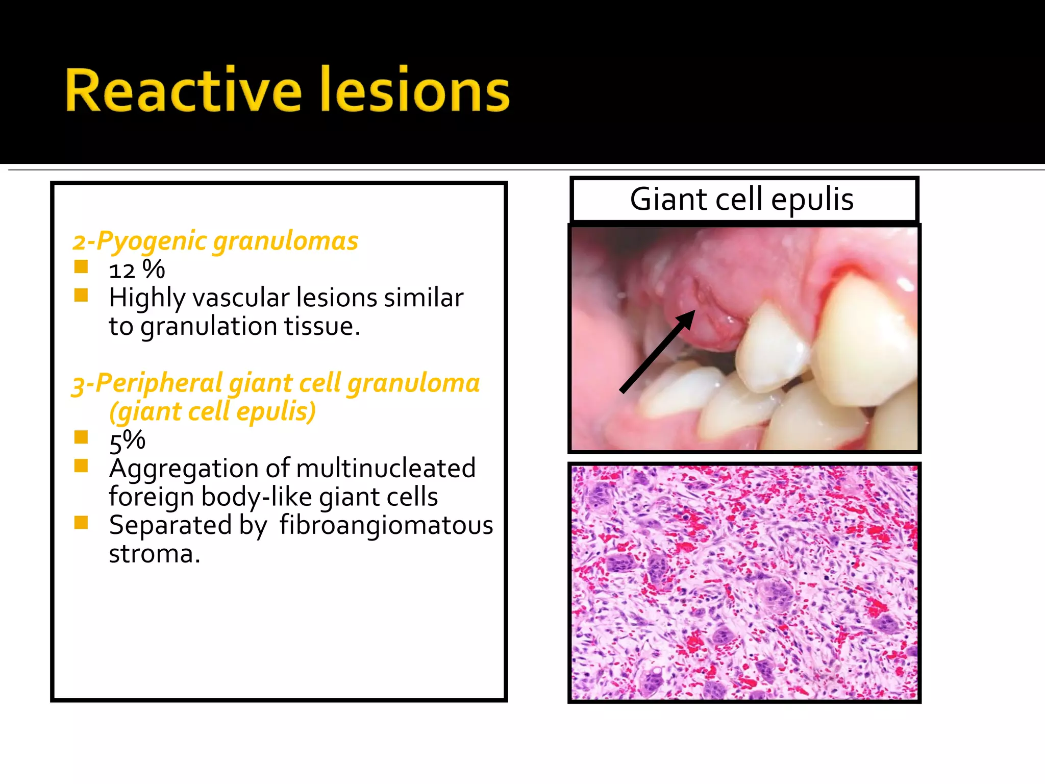 Diseases of oral cavity and ludwig’s angina ug,18.07.16 dr.davis thomas ...