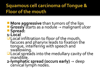 Diseases of oral cavity and ludwig’s angina ug,18.07.16 dr.davis thomas ...