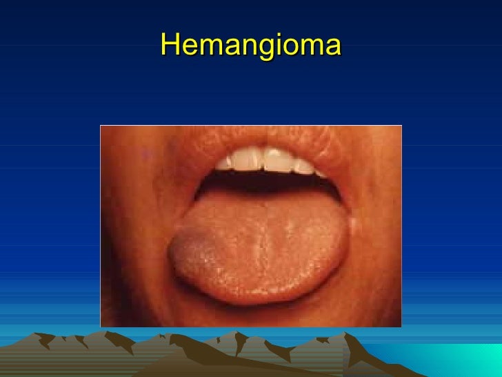 Diseases of oral cav, nasoph and oroph