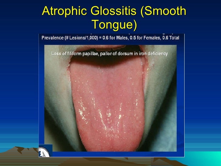Diseases of oral cav, nasoph and oroph