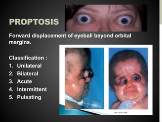 diseases of orbit of eye related concepts | PPTX