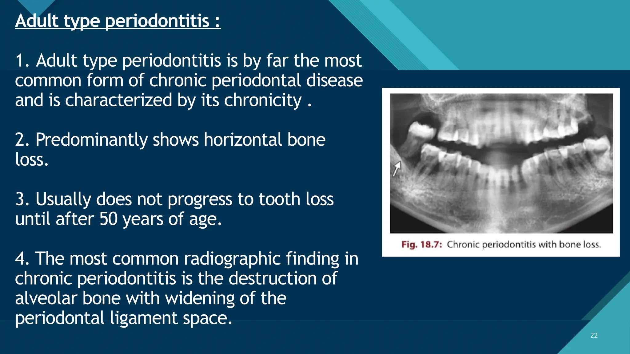 Diseases of Periodontium perio ppt 2.pptx