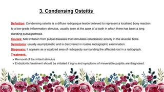 Diseases of Periradicular Tissues PPT (1).pptx.pdf.pdf