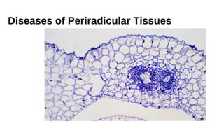 Diseases of Periradicular Tissues PPT (1).pptx.pdf.pdf