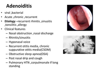Diseases of Pharynx.pptx