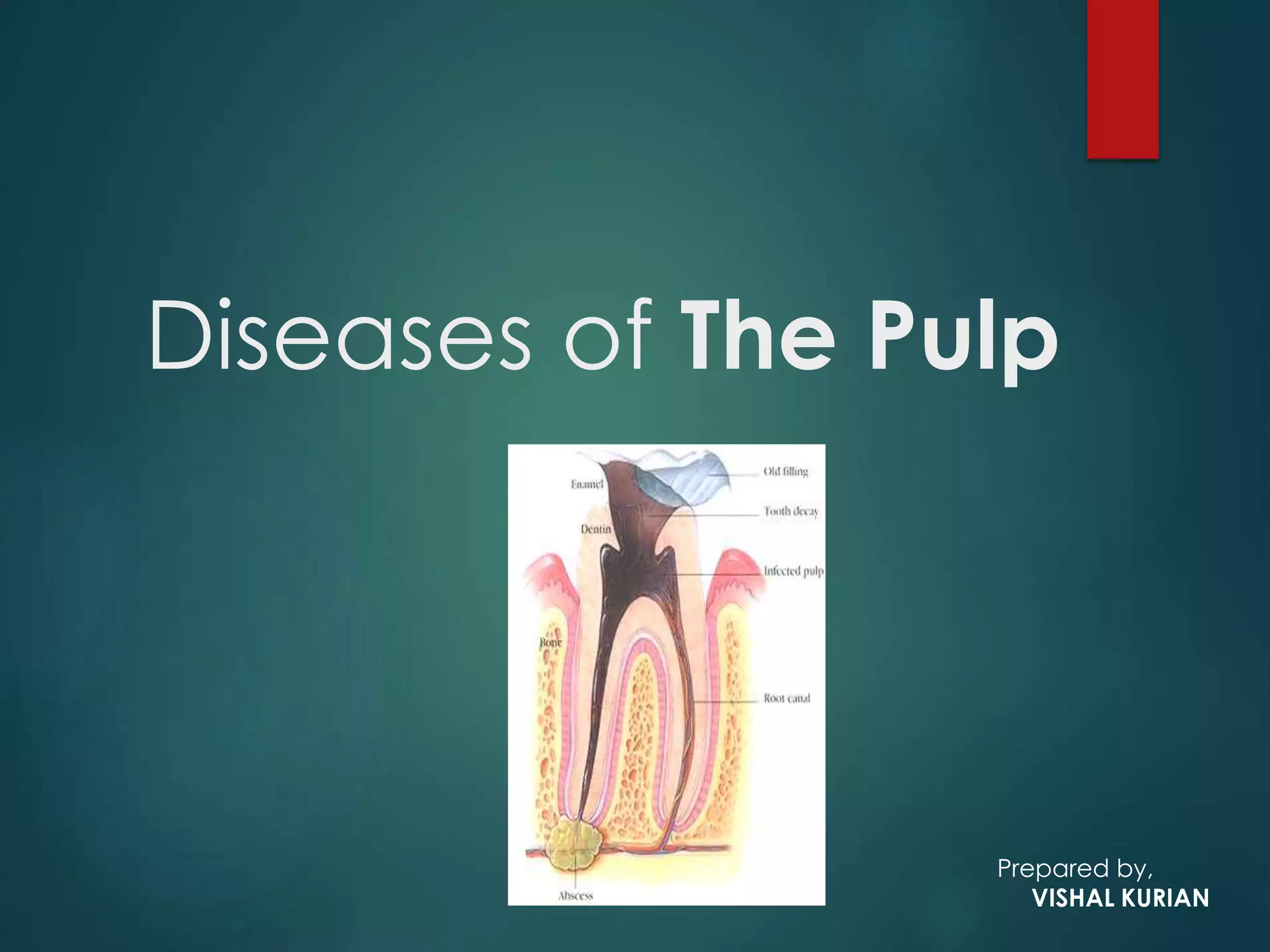 Diseases of pulp | PPTX