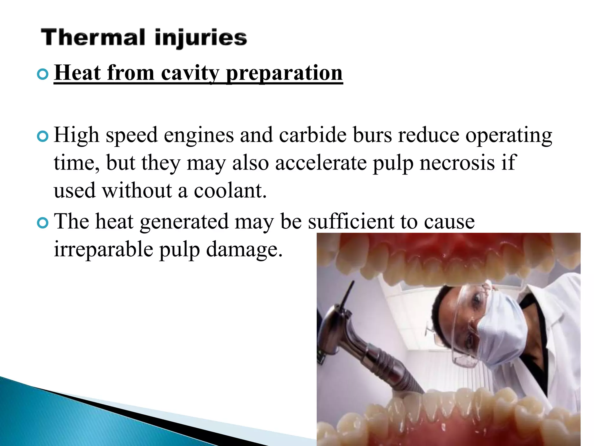 Diseases of pulp | PPTX