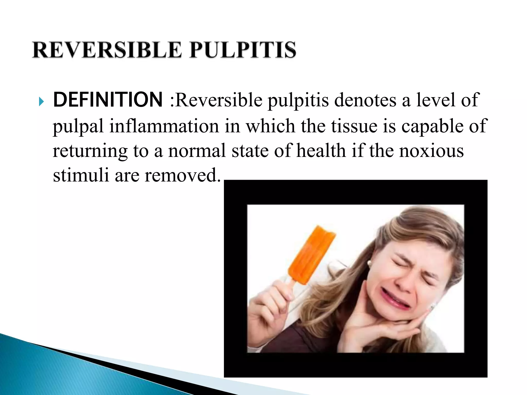 Diseases of pulp | PPTX