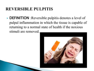 Diseases of pulp | PPTX