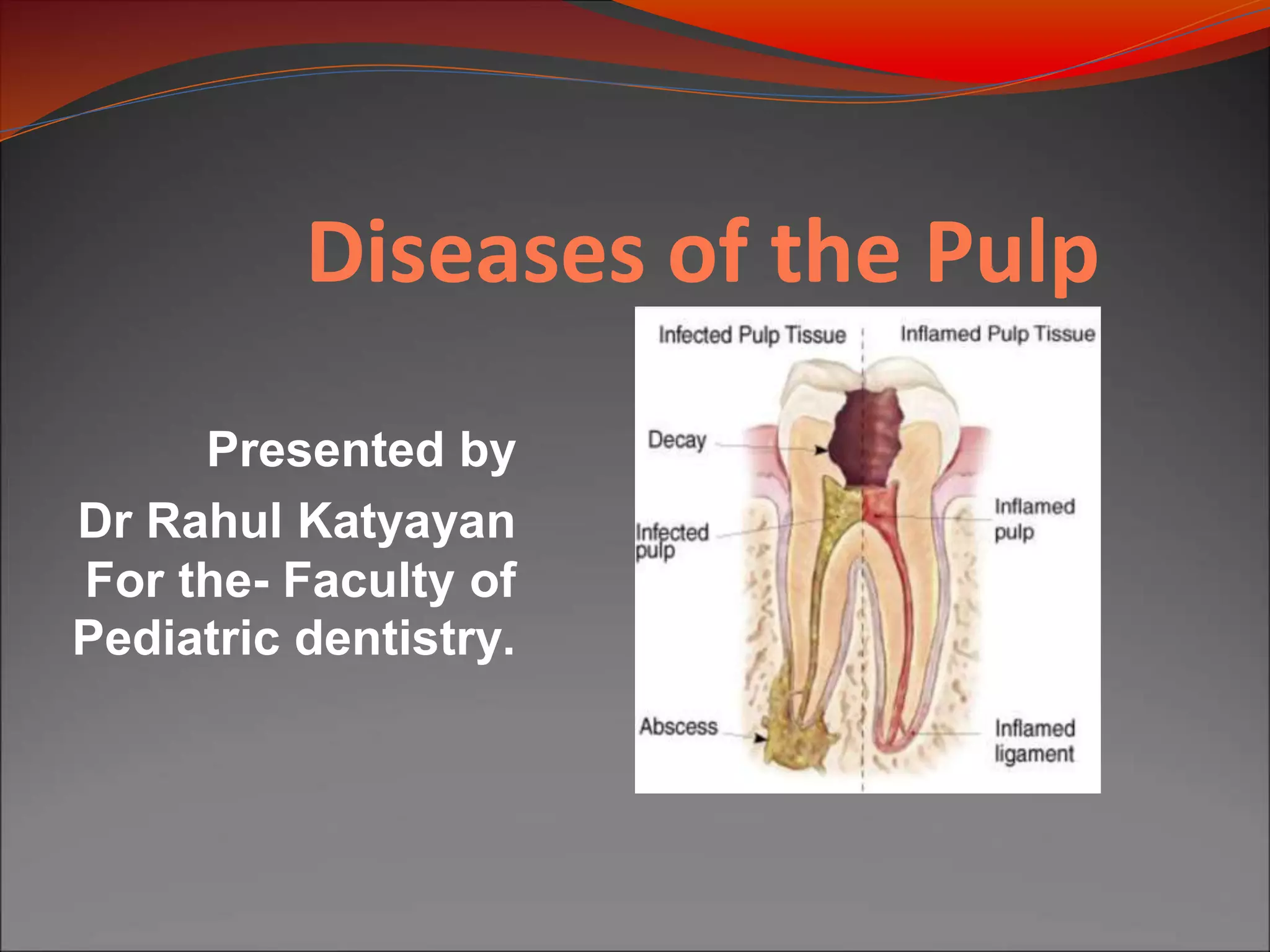 Diseases of pulp | PPTX