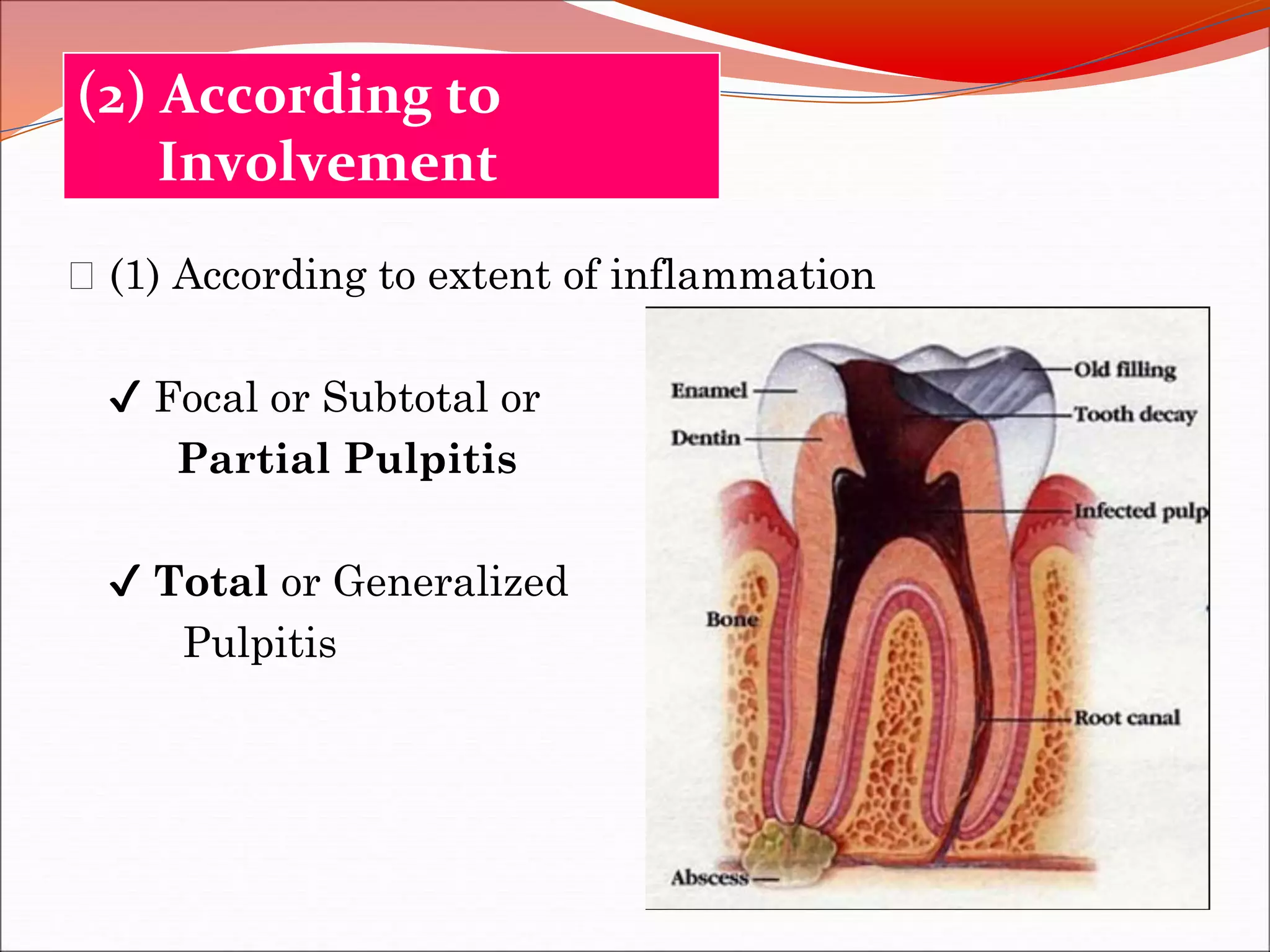 Diseases of pulp | PPTX