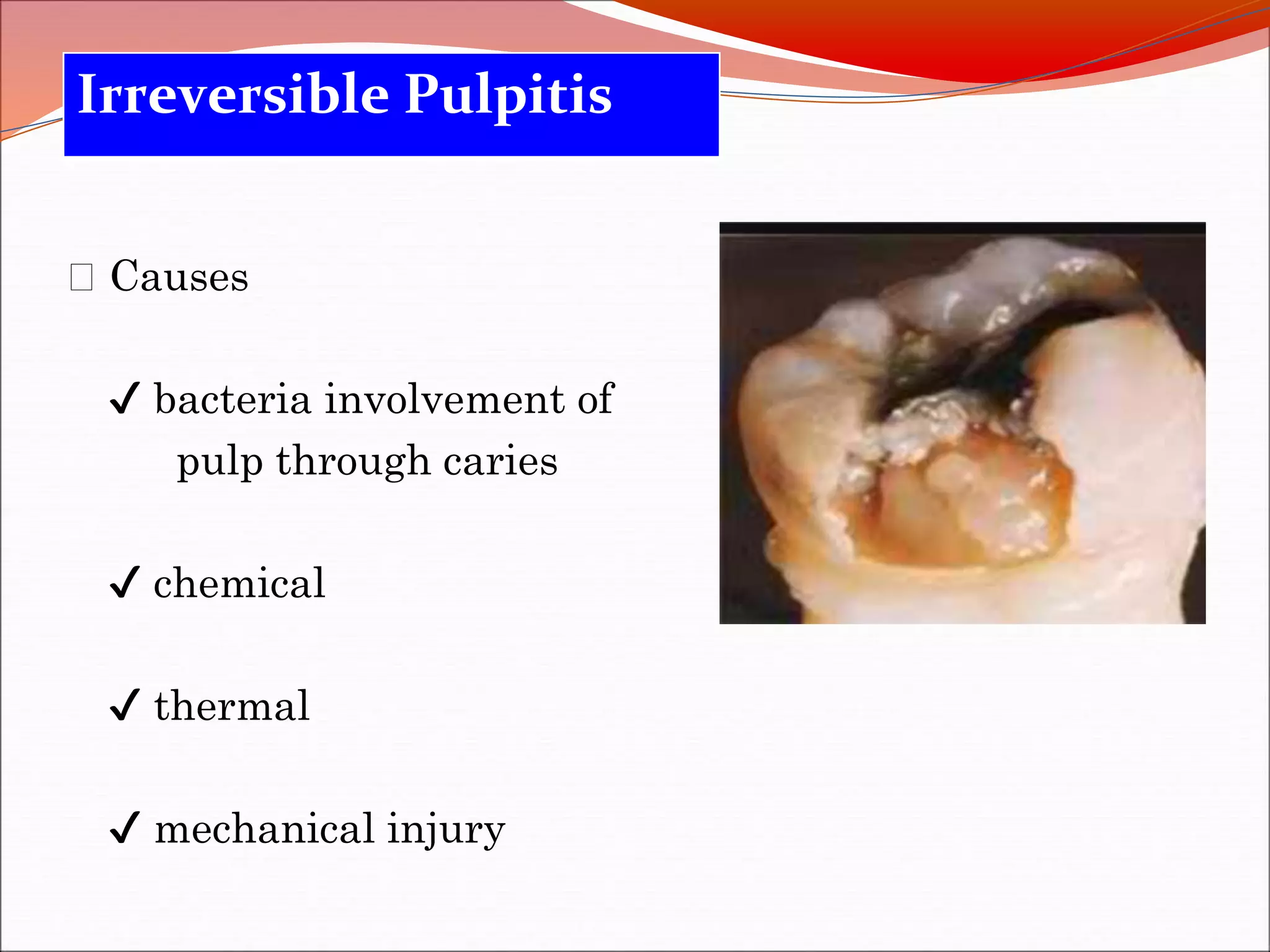 Diseases of pulp | PPTX | Dental Health | Diseases and Conditions