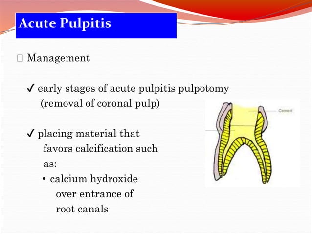 Diseases of pulp | PPTX | Dental Health | Diseases and Conditions