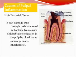 Diseases of pulp | PPT