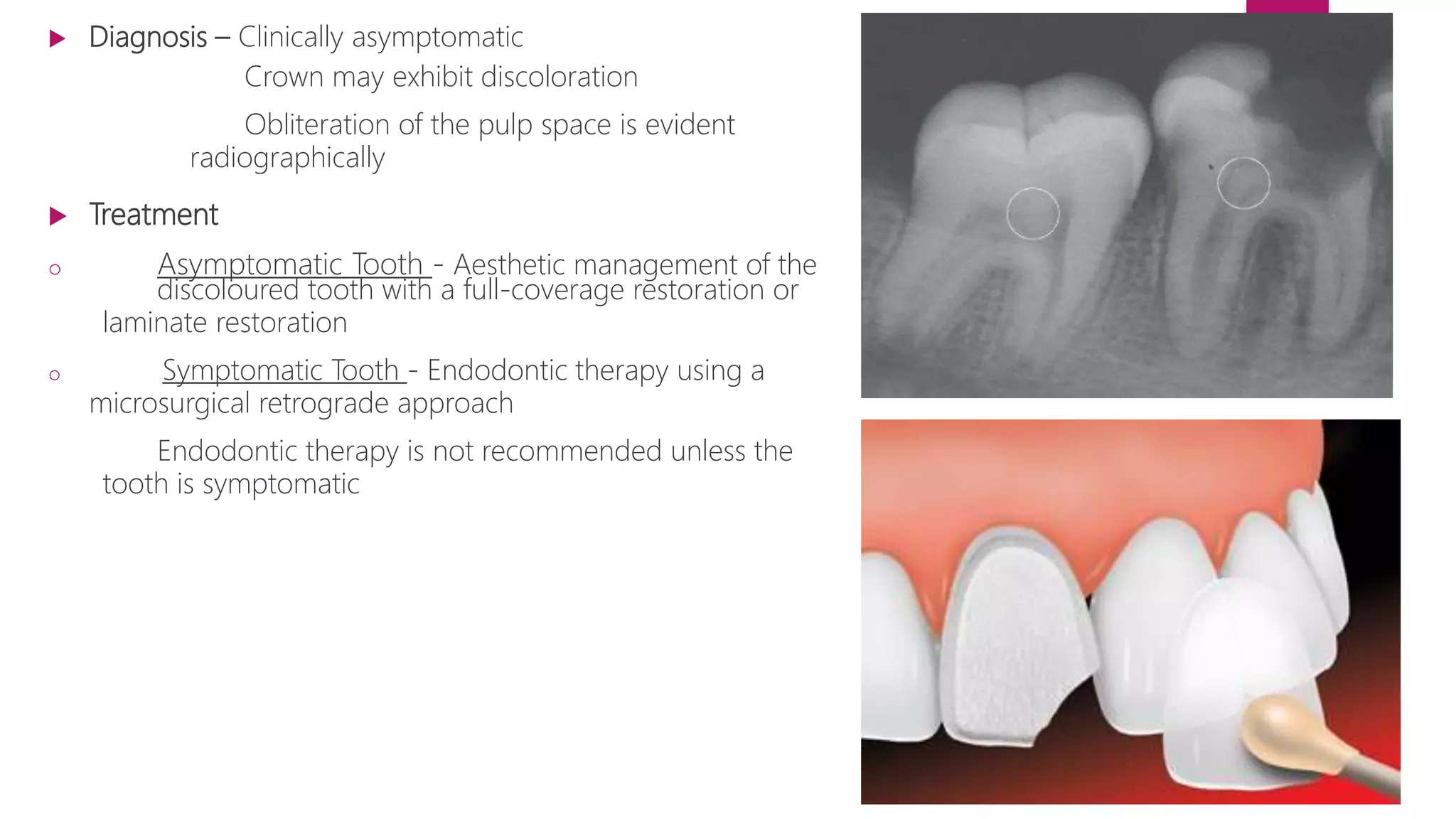 Diseases of pulp | PPTX