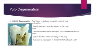 Diseases of pulp | PPTX