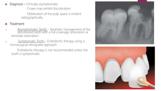Diseases of pulp | PPTX