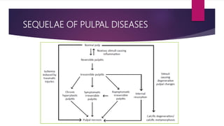 Diseases of pulp | PPTX