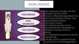 Diseases of pulp | PPTX