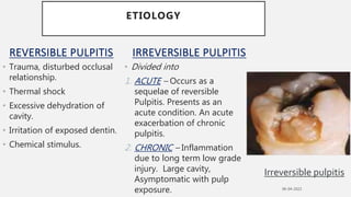 Diseases of pulp | PPTX