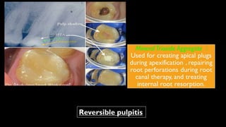 Diseases of pulp | PPTX