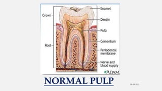 Diseases of pulp | PPTX
