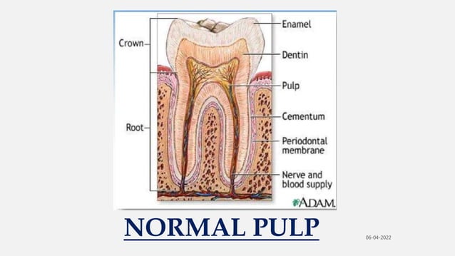 Diseases of pulp | PPTX | Dental Health | Diseases and Conditions