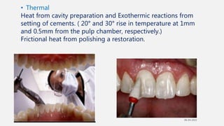Diseases of pulp | PPTX
