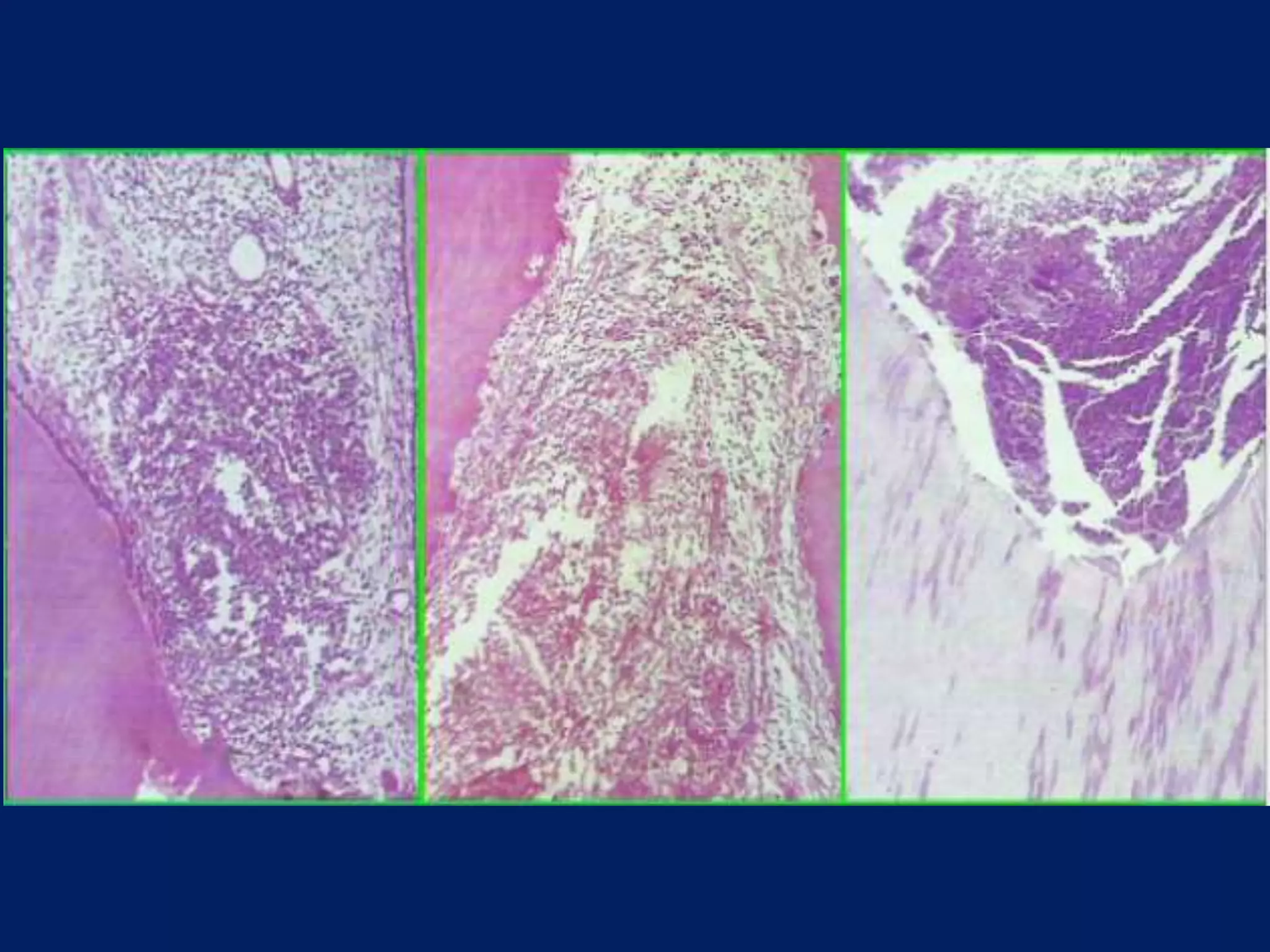 Diseases of pulp and periapical tissues | PPTX | Dental Health ...