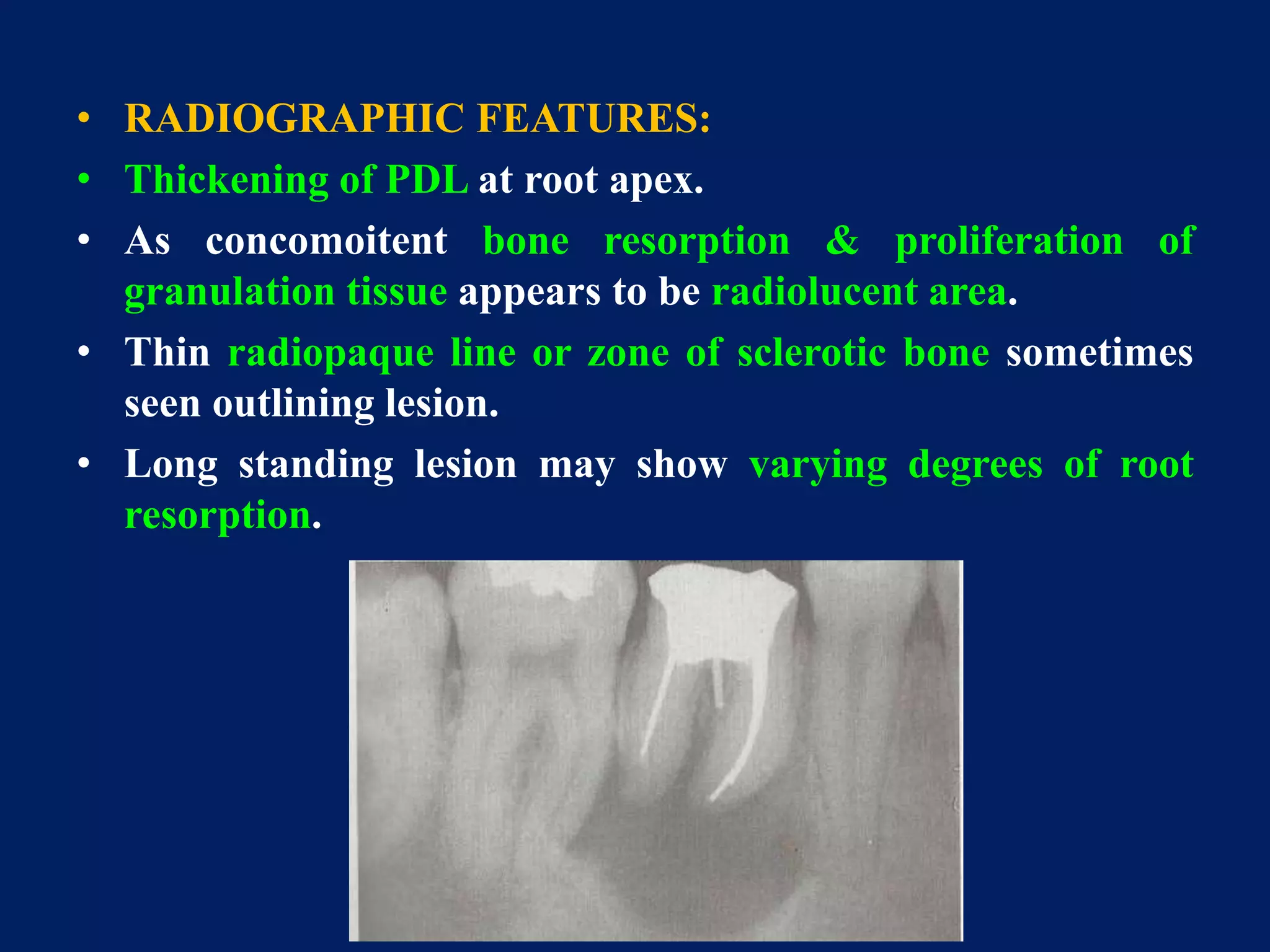 Diseases of pulp and periapical tissues | PPTX