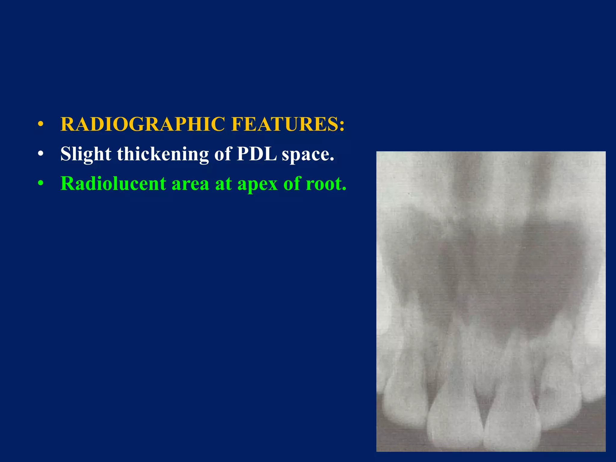 Diseases of pulp and periapical tissues | PPTX | Dental Health ...