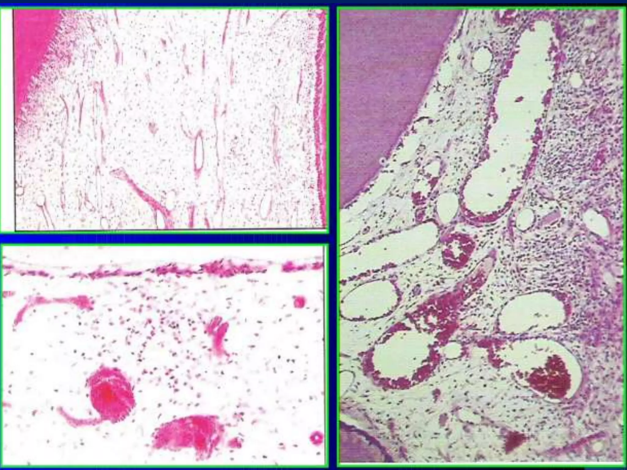 Diseases of pulp and periapical tissues | PPTX | Dental Health ...