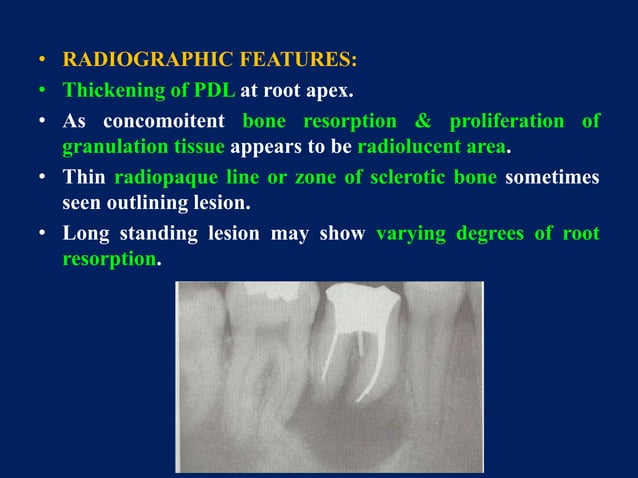Diseases of pulp and periapical tissues | PPTX | Dental Health ...