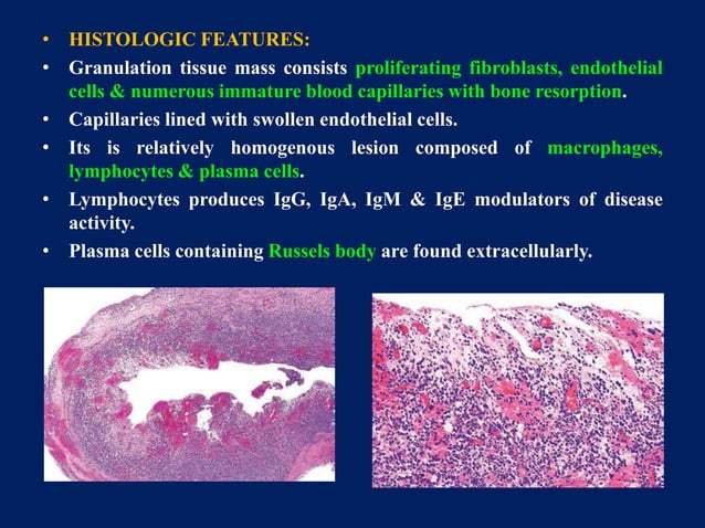 Diseases of pulp and periapical tissues | PPTX | Dental Health ...