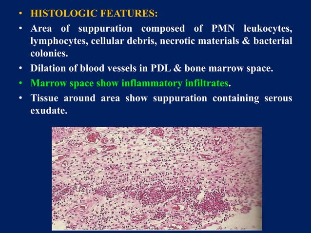 Diseases of pulp and periapical tissues | PPTX | Dental Health ...