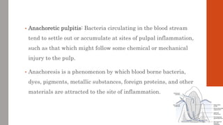 Diseases of pulp for ugs | PPTX