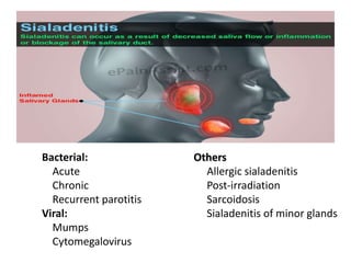 Diseases of salivary gland | PPTX