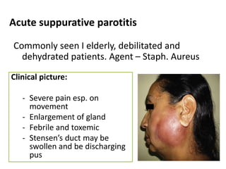 Diseases of salivary gland | PPTX
