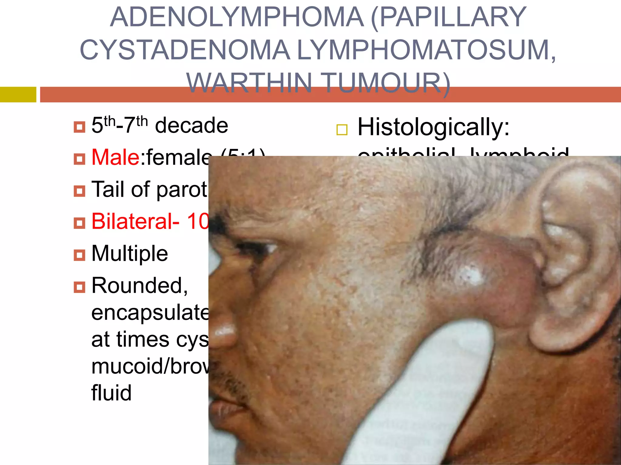 Diseases of salivary gland | PPTX