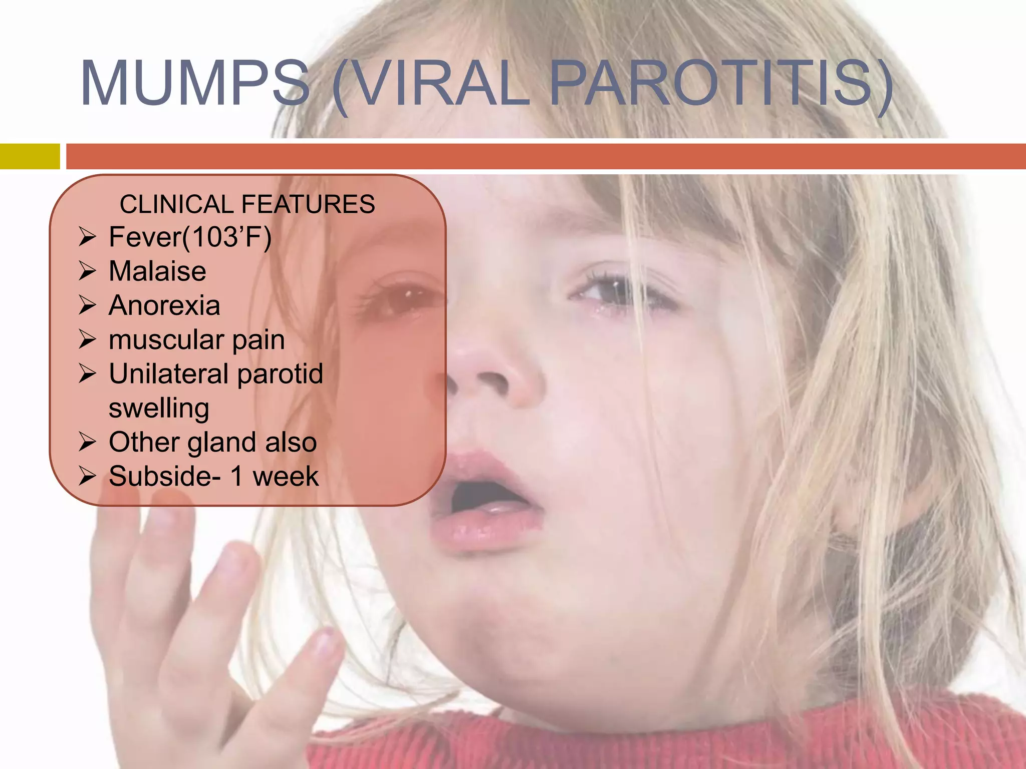 Diseases of salivary gland | PPTX