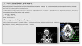 DISEASES OF SALIVARY GLANDS.pptx
