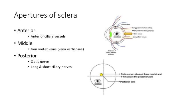 Diseases of sclera