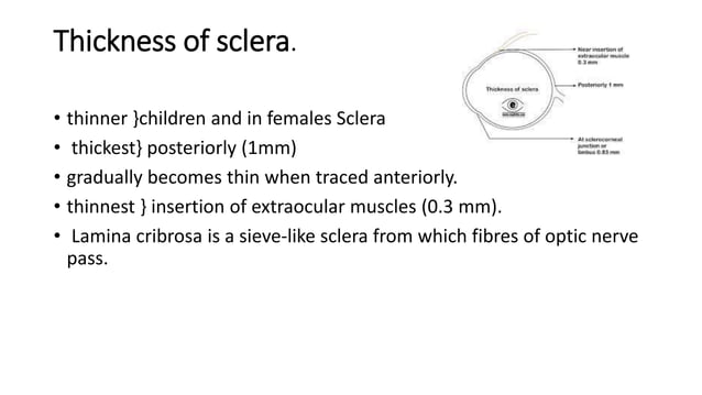 Diseases of sclera ppt ophthalmology | PPTX | Eye and Vision Conditions ...