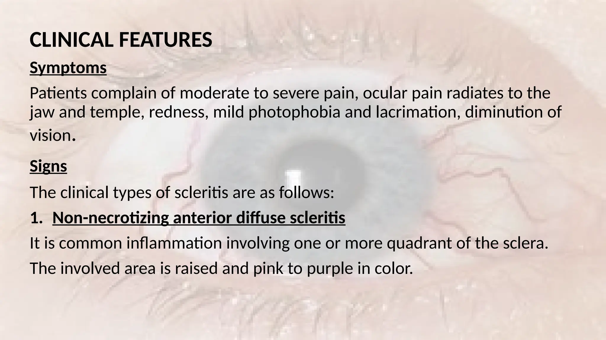DISEASES OF SCLERA, DISEASES OF SCLERApptx | PPTX