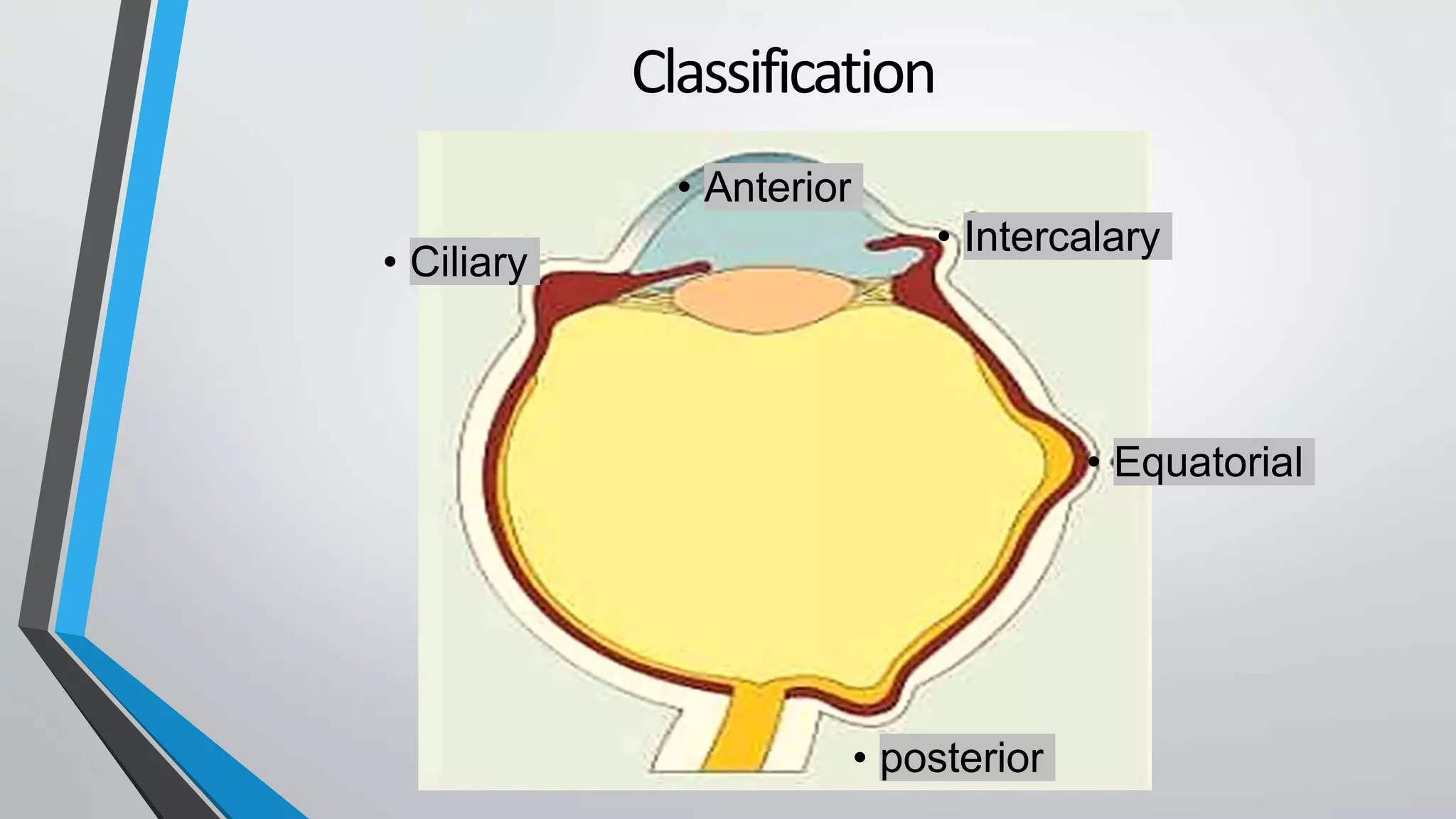 Diseases of sclera | PPTX