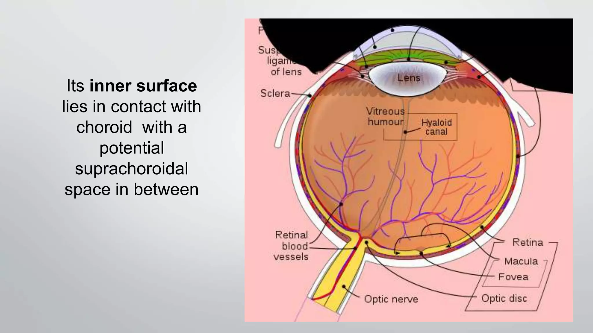 Diseases of sclera | PPTX