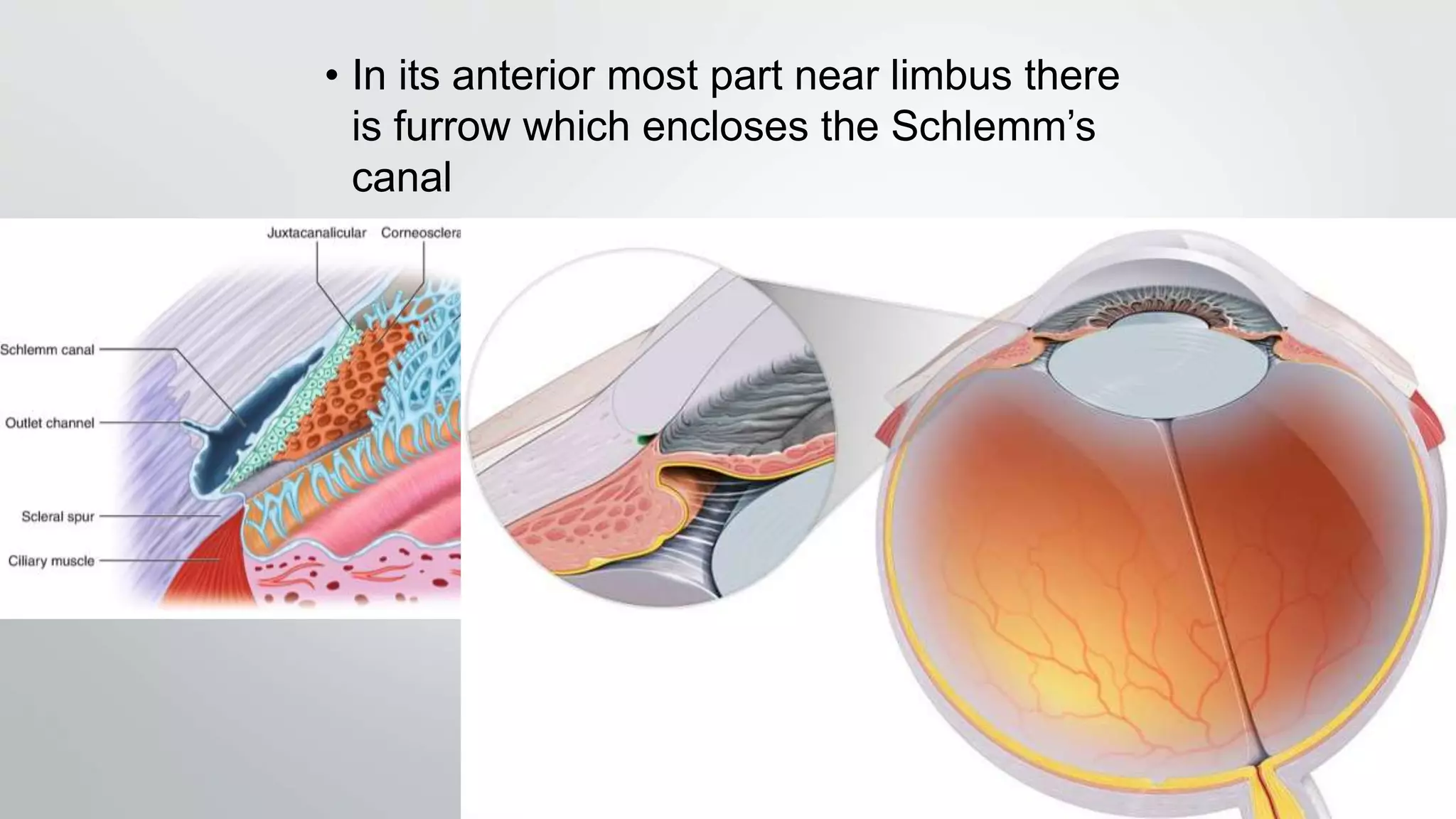 Diseases of sclera | PPTX