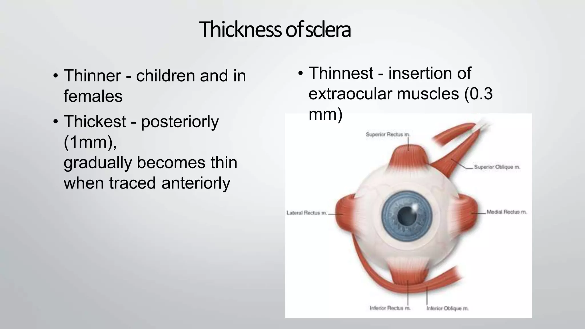 Diseases of sclera | PPTX